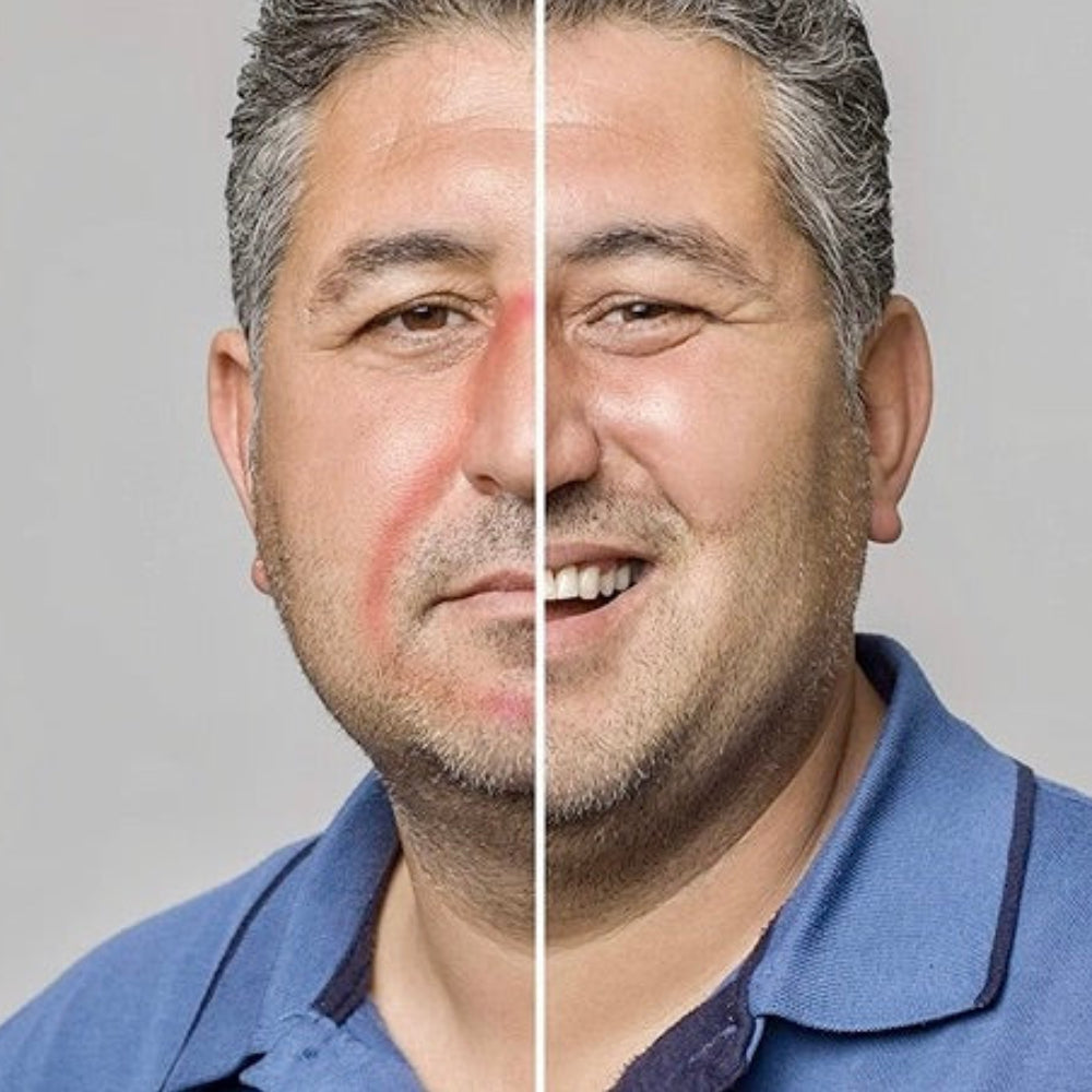 CPAP PRO — The "No Mask" CPAP System